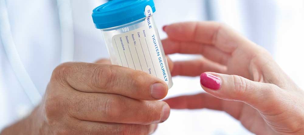 Employer Drug Screening ‚Äì What to Know